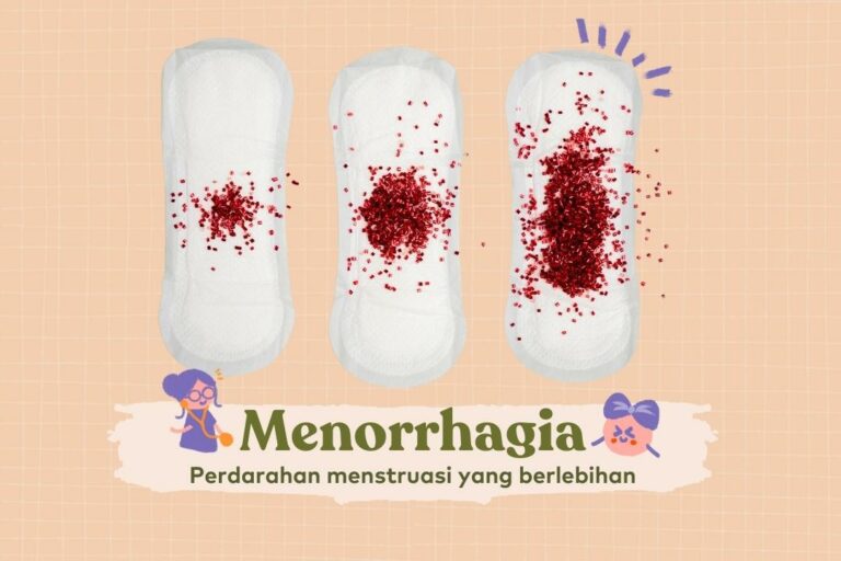 Menorrhagia - Gejala, Penyebab, dan Cara Mengobati