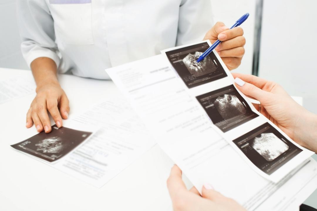 Apakah PCOS Bisa Didiagnosis Melalui USG? - Bocah Indonesia
