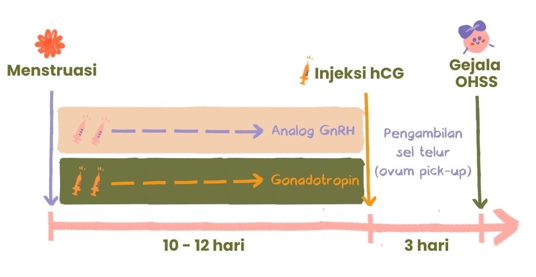 OHSS - Ovarian Hyperstimulation Syndrome - Bocah Indonesia