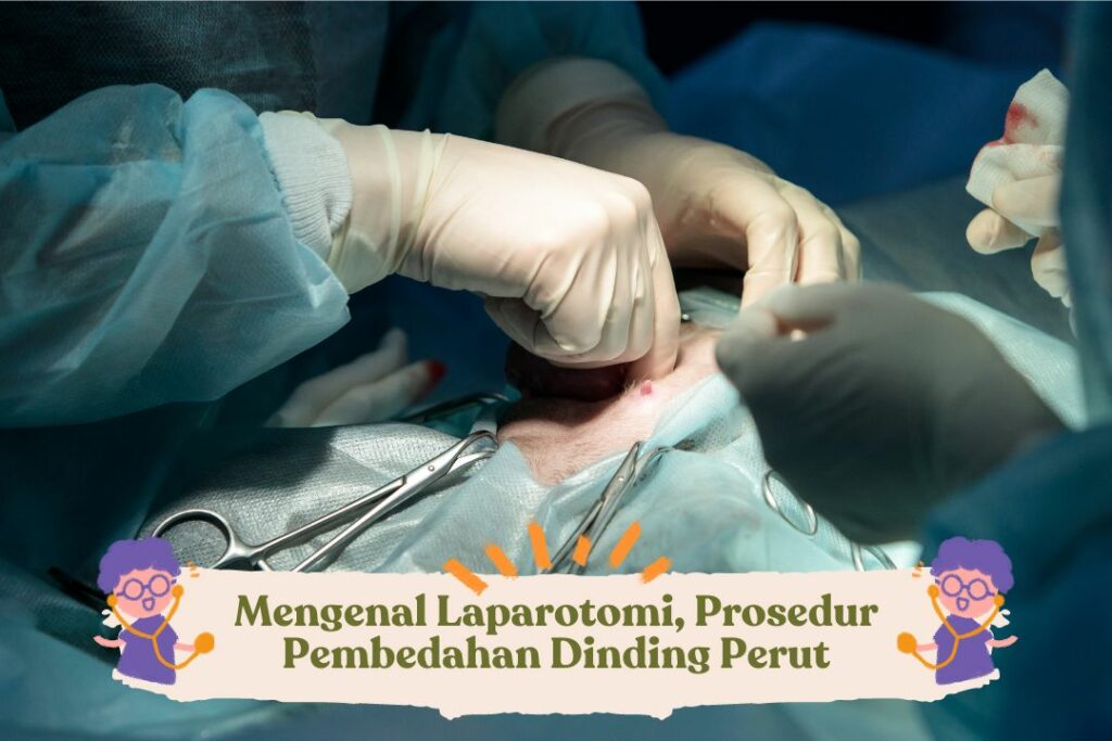 Mengenal Laparotomi, Prosedur Pembedahan Dinding Perut