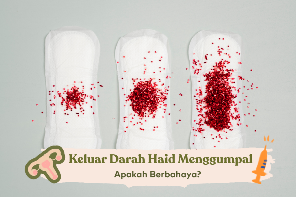Keluar Darah Haid Menggumpal, Apakah Berbahaya?