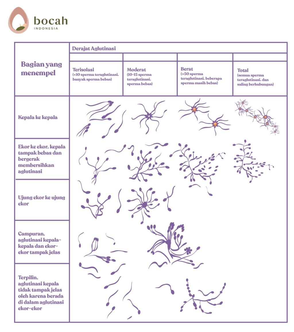 Sperm Agglutination on Male Fertility